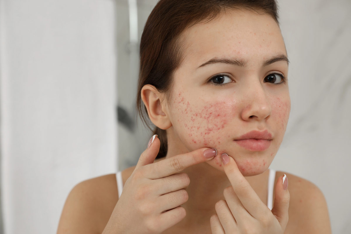 Tiroiditis de Hashimoto: dieta y suplementos | HoliHerb